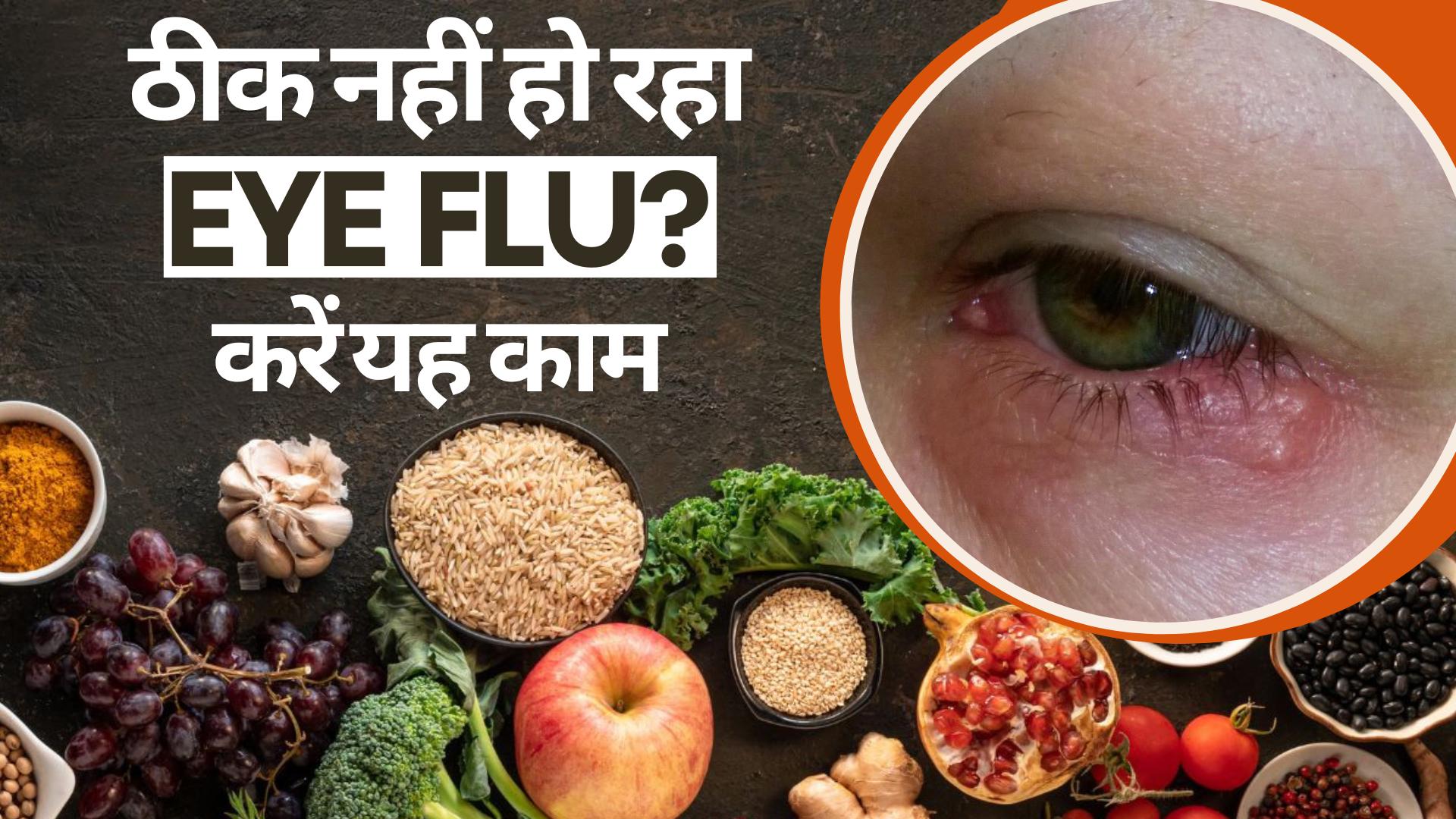 Eye Flu Prevention Tips: ठीक नहीं हो रहा Eye flu? करें यह काम, मिलेगा Instant आराम - Watch Video
