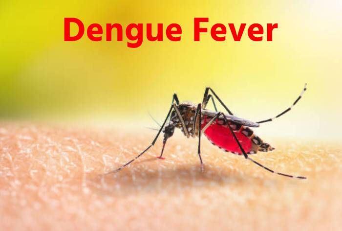 Dengue Fever: जानिए डेंगू के लक्षण और इलाज, 5 फूड जो जल्दी रिकवरी कराएंगे