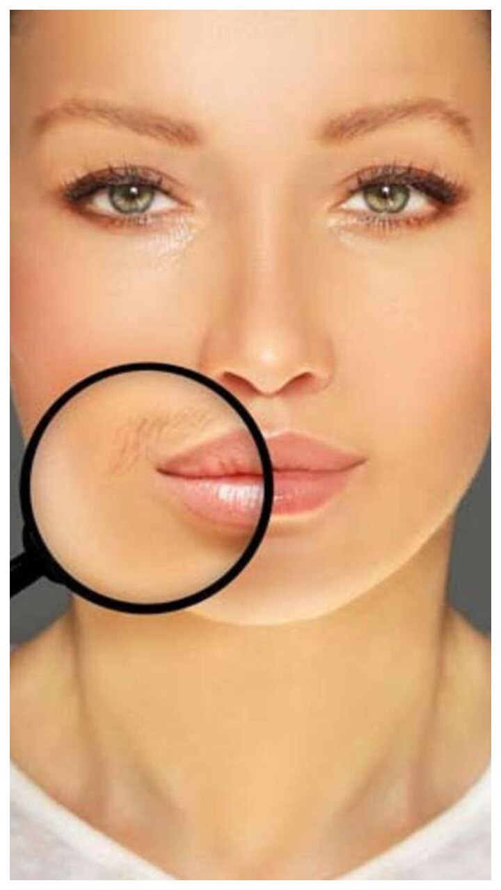 Upper Lips के बाल हटाने के 7 घरेलू उपाय