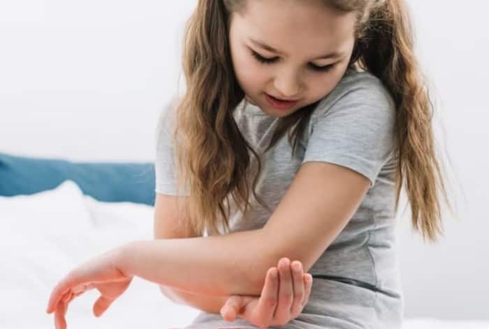 What is Juvenile Arthritis? 5 Signs to Identify Joint Pain And Swelling ...