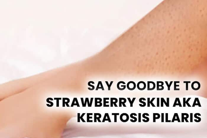 What is Strawberry Skin And Expert Tips To Treat It | India.com