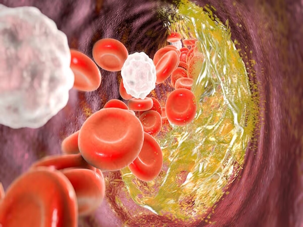 Cholesterol Control Tips: 7 बातों का रखेंगे ख्याल तो जड़ से खत्म हो ...