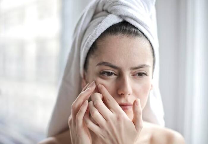 Peeling Skin: 5 Causes And Remedies For a Healthy And Radiant Glow
