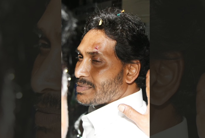 Andhra Pradesh CM Jagan Mohan Reddy Injured After Stone Hurled At Him In Vijayawada