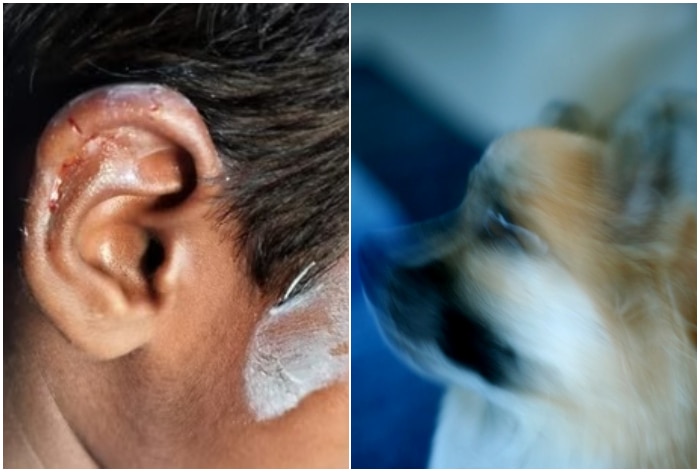 Dog Bites 5-Year-Old Childs Ear in Bengaluru, Prompting Online Debate ...