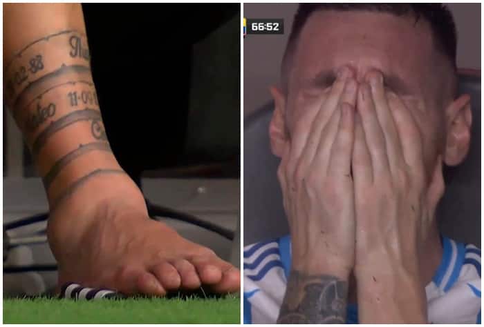 PICTURES of Lionel Messis Swollen Injured Feet Goes VIRAL During ...