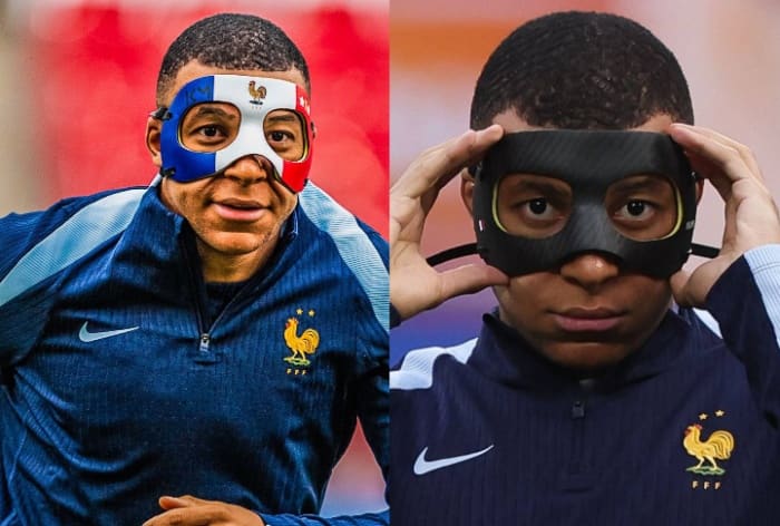 Third Face Mask For Kylian Mbappe In Three Euro 2024 Matches; Heres What Bothering French ...