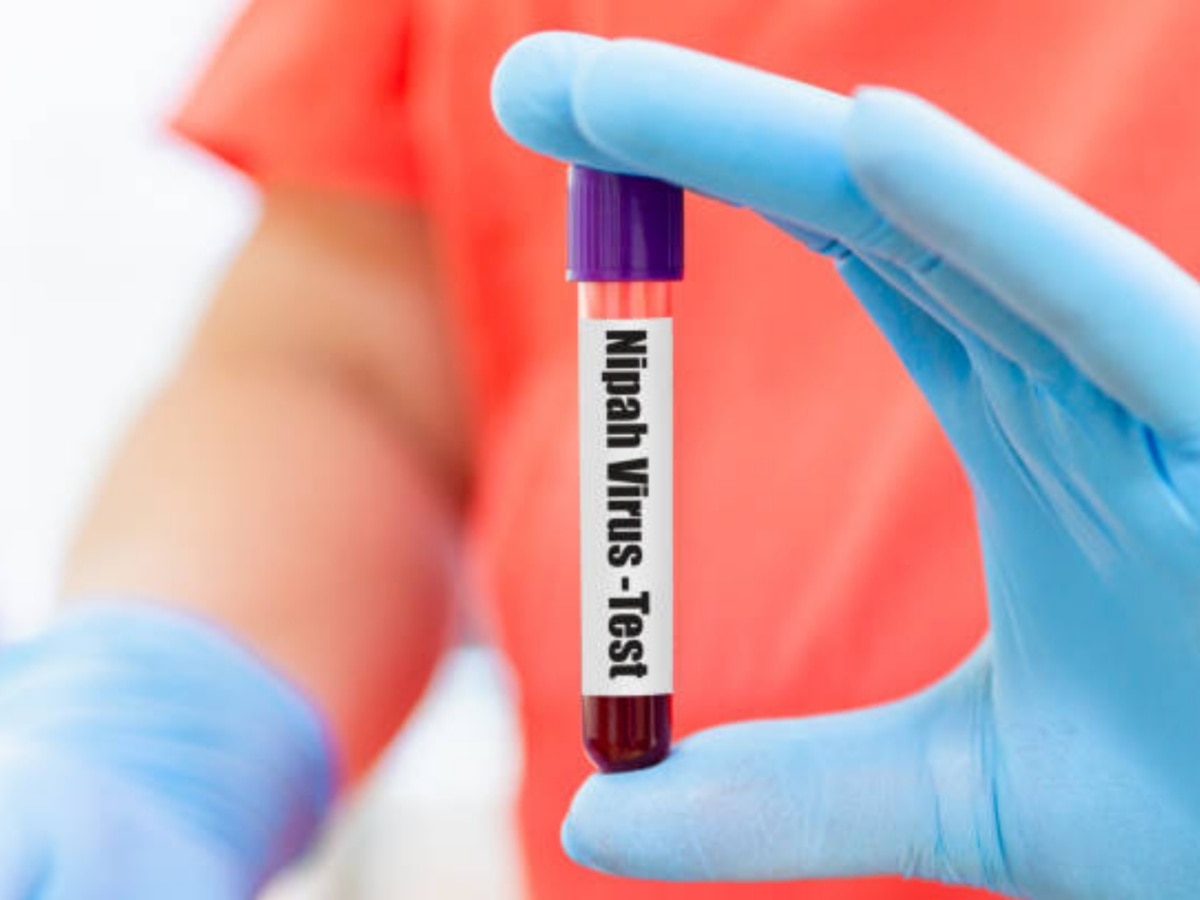 Kerala Nipah Virus Outbreak: Deceased Boy's Close Relatives Test ...