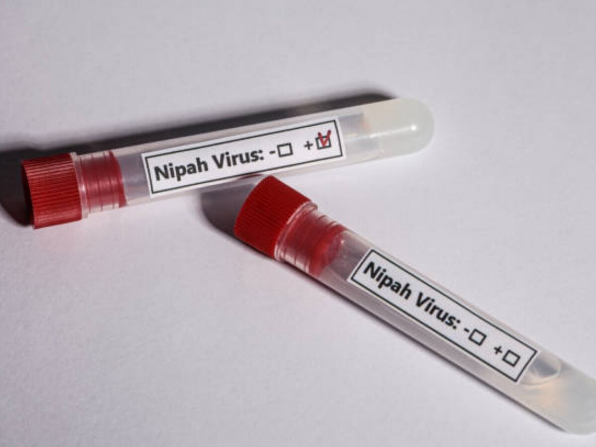 Kerala Nipah Virus Outbreak: 2 More On Deceased Boy's Contact List Test ...