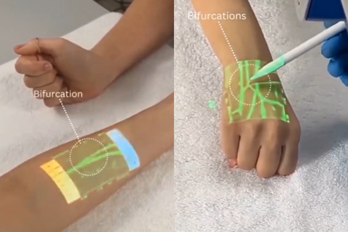 Anand Mahindra's Video Of Hi-tech Device Finding Veins Goes Viral
