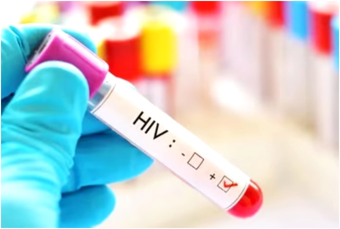 Tripura On Alert As HIV Infection On Rise In State, 47 Students Dead ...