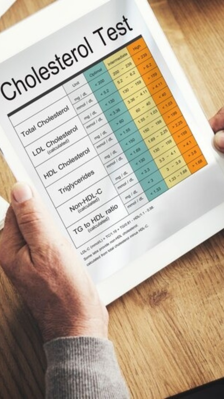 7 Everyday Foods That May Increase Cholesterol Levels