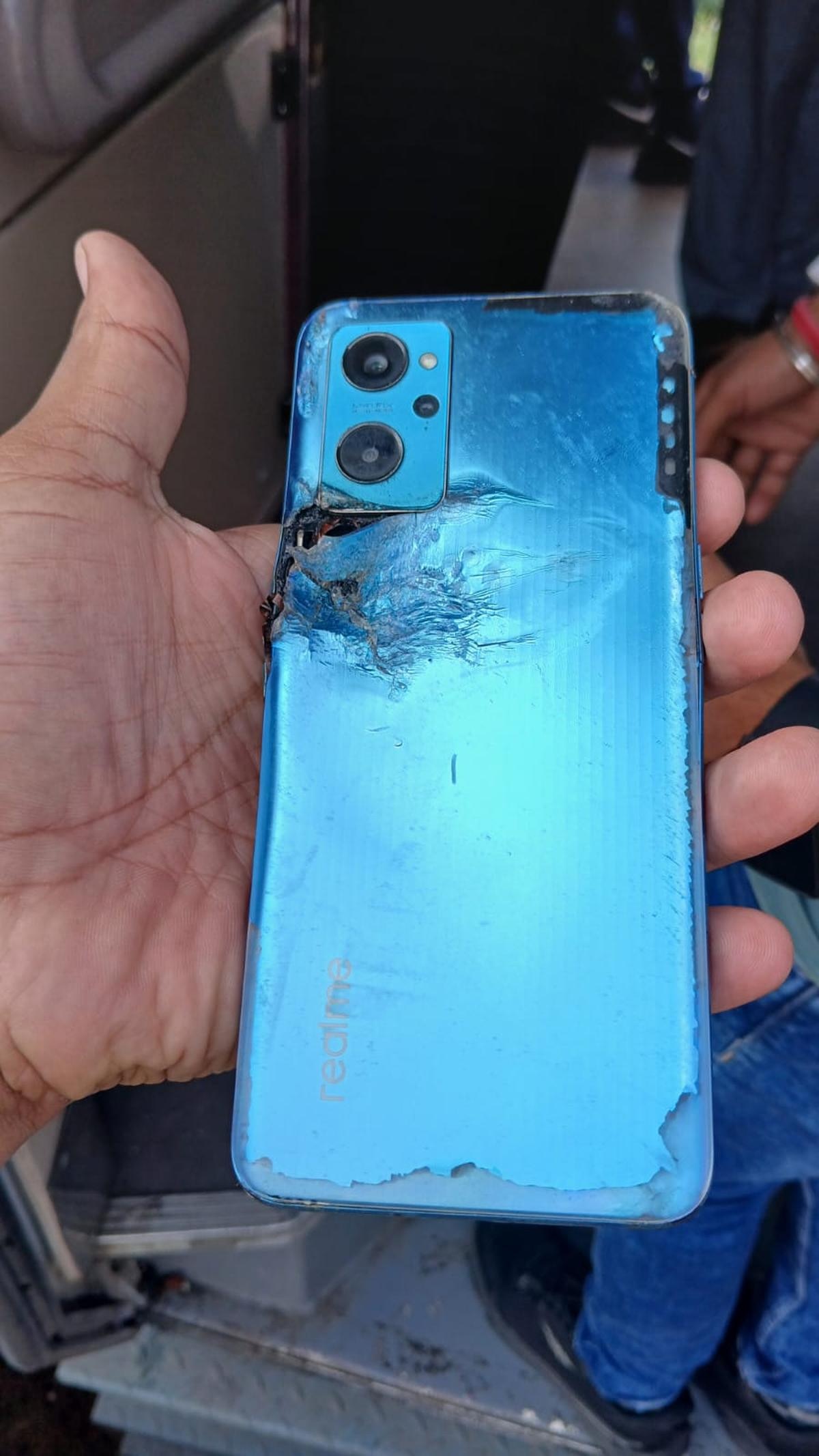 Mobile Phone Explodes In 9-Year-Old Boy Hand While Watching Cartoon In ...