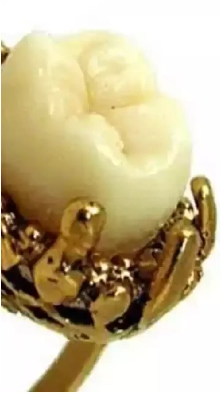 World’s most expensive human tooth is worth Rs...,belongs to...
