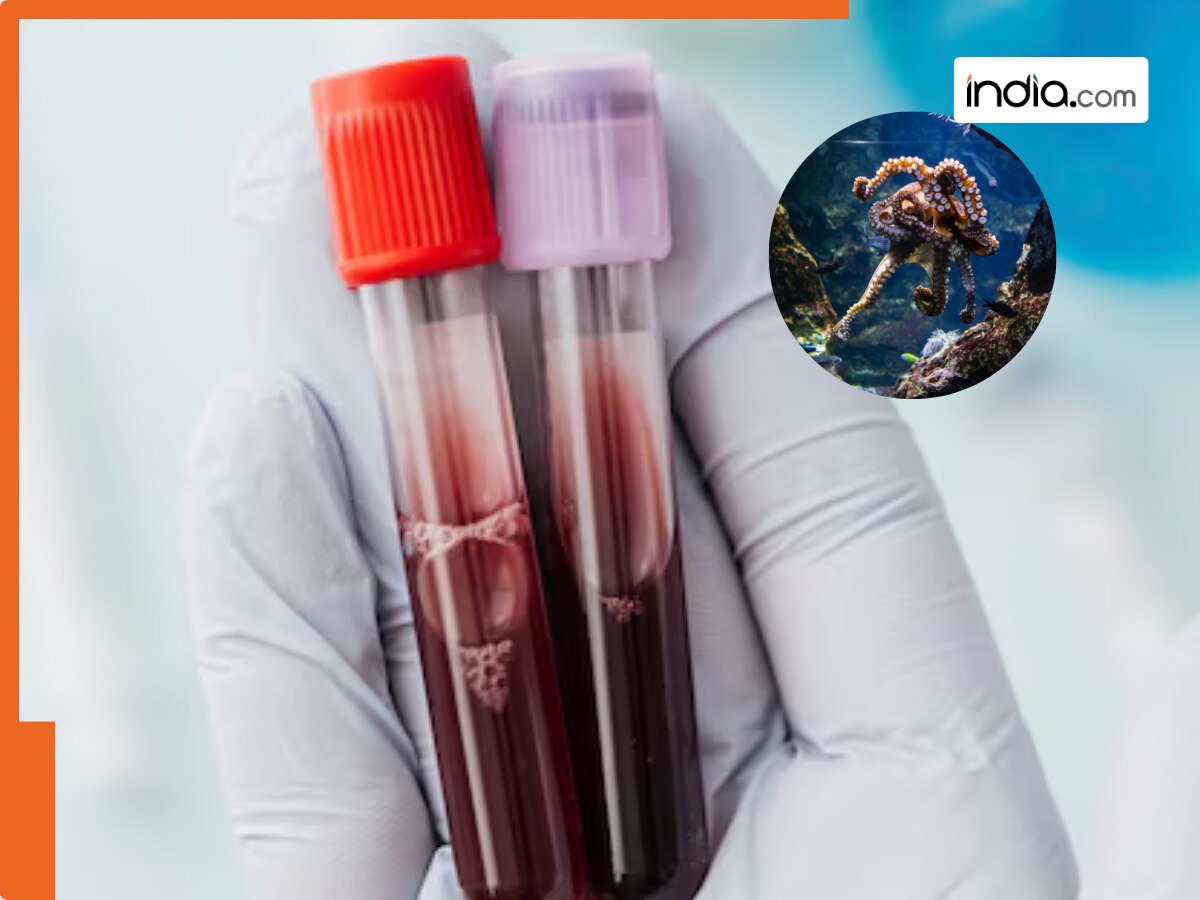 Photos: लाल रंग का नहीं बल्कि हरा, नीला और पीला होता है इन जानवरों का खून