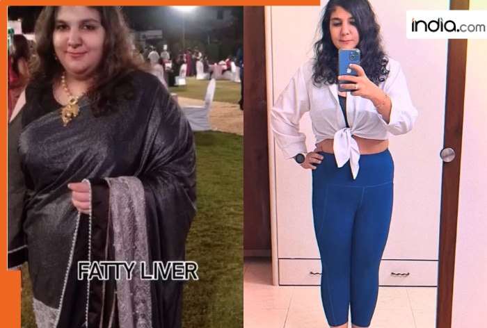 Weight loss story: Woman reveals how she reversed PCOS and lost 42 ...