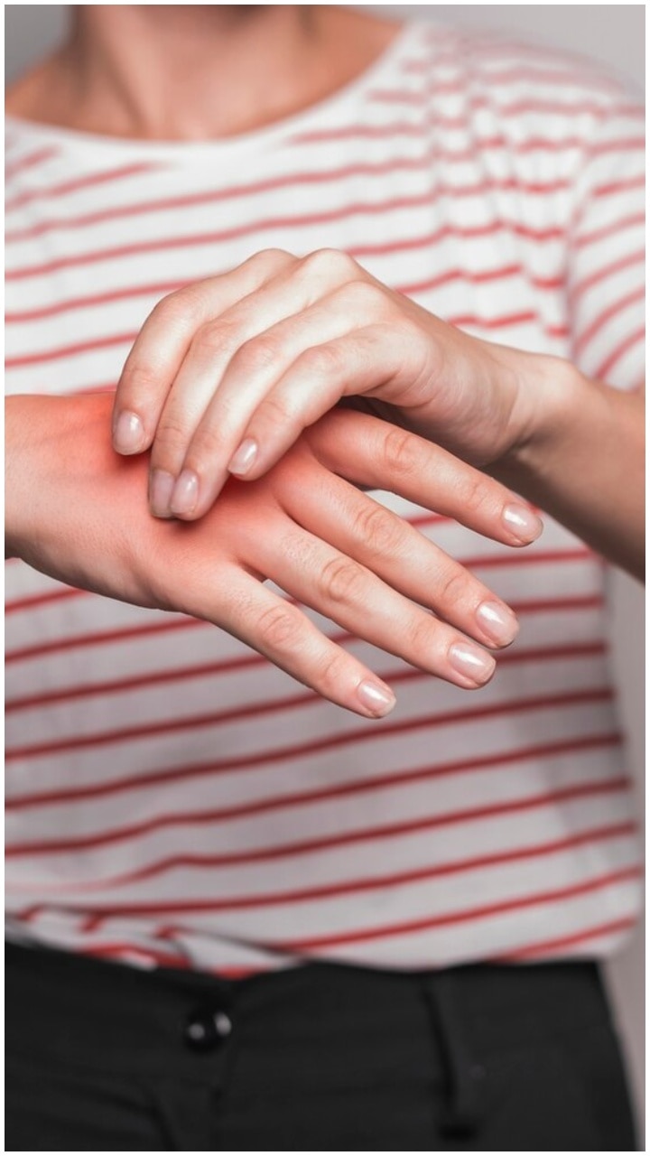 Uric acid tips: 5 red superfoods to prevent gout risk