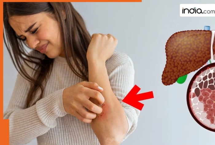 Fatty liver disease: Common signs and symptoms you must not ignore