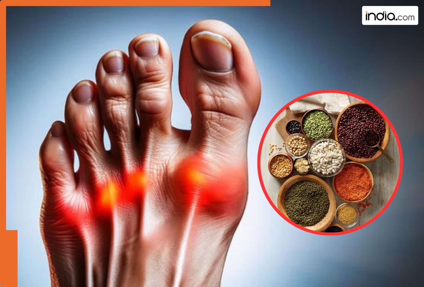 इन 4 दालों का सेवन तेजी से बढ़ा सकता है यूरिक एसिड लेवल....जाम हो ...
