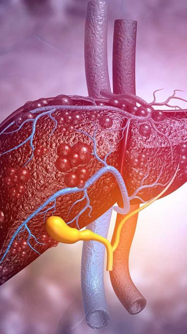8 simple steps to check fatty liver at home