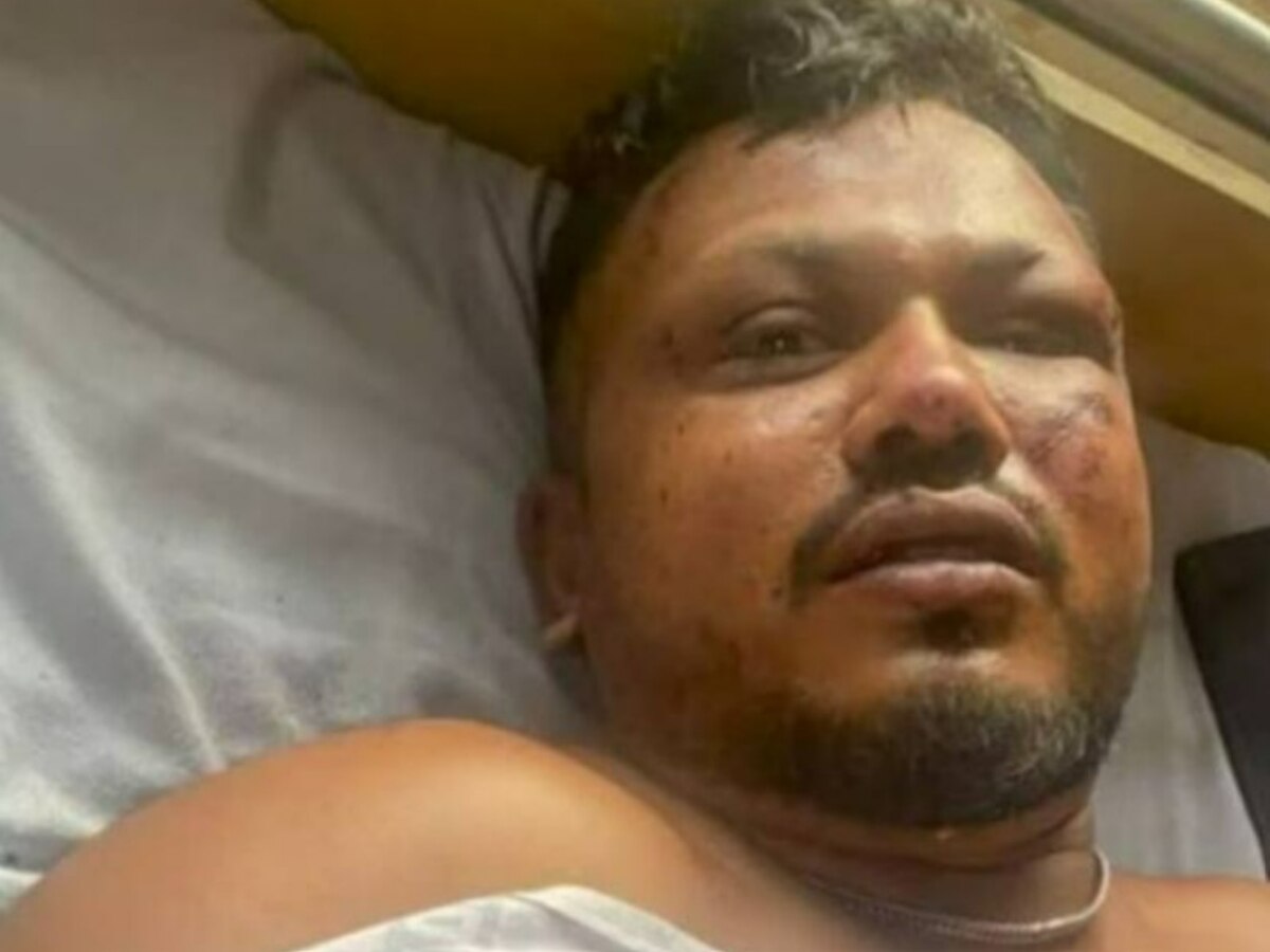 एयर इंडिया विमान हादसे में जिंदा बचा एकमात्र शख्स नहीं लौटा अपने घर, 3 ...