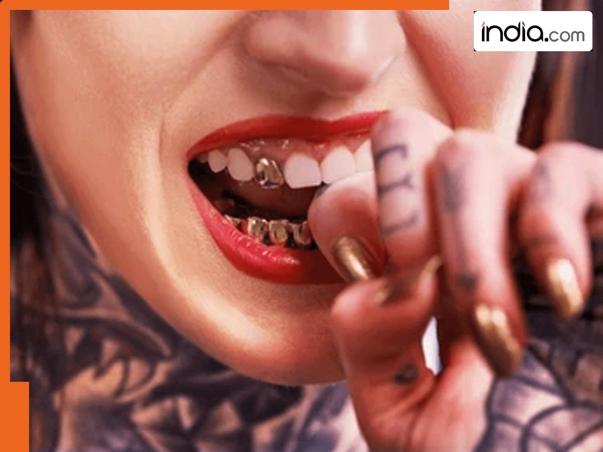 Gold Teeth Price in India: फैशन नहीं मजबूरी भी? सोने के दांत क्यों ...