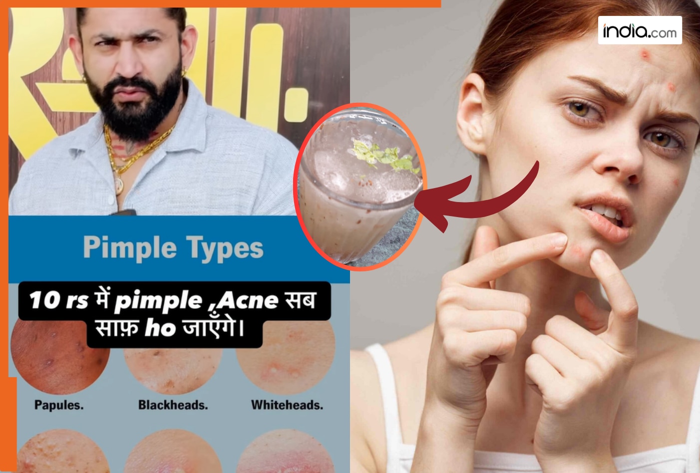 पिंपल्स पर कुछ भी नहीं कर रहा है काम? बाजार से खरीद लाओ ये 10 रुपए वाली ...