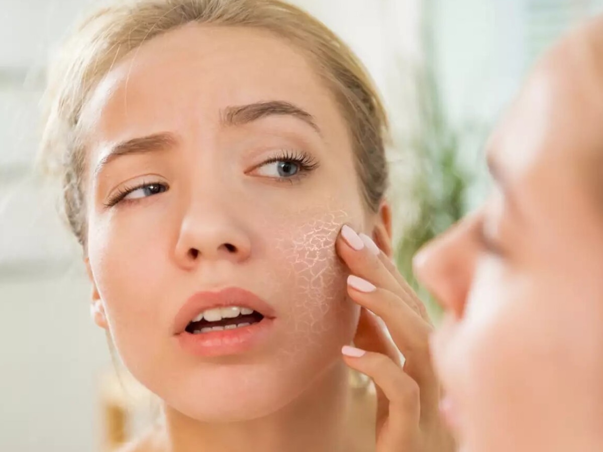 coconut oil, alum, freckles removal